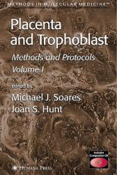 【预售】Placenta and Trophoblast: Methods and Protocols