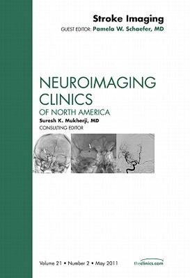 【预售】Stroke Imaging, an Issue of Neuroimaging Clinics