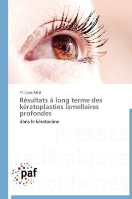 【预售】R Sultats Long Terme Des K Ratoplasties Lamellaires