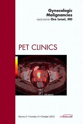 【预售】Gynecologic Malignancies