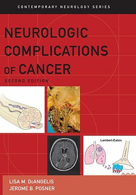 【预订】Contemporary Neurology Series