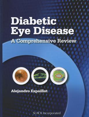 【预售】Diabetic Eye Disease: A Comprehensive Review