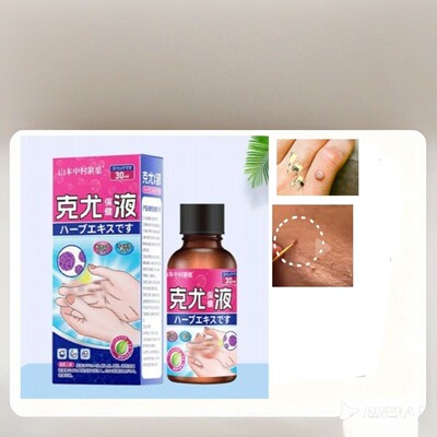 手指上长疙瘩刺瘊子手指肉刺球手足凸起寻常疙瘩粗糙肉钉温和液