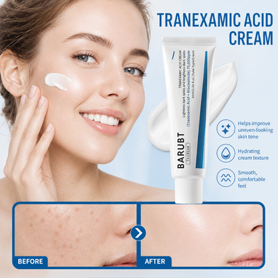 氨甲环酸霜乳膏黄褐斑保湿补水Face cream for freckle removal