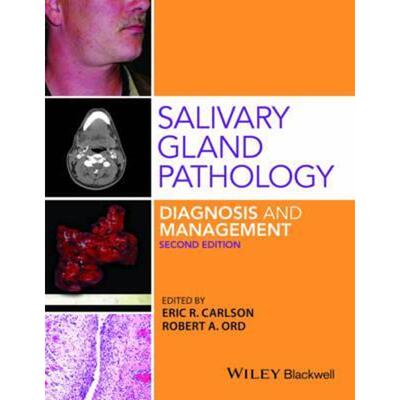 预订Salivary Gland Pathology