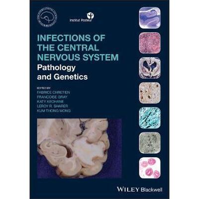 按需印刷不退不换Infections of the Central Nervous System:Pathology and Genetics[9781119467762]