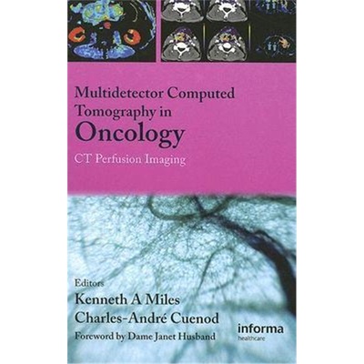 预订Multi-Detector Computed Tomography in Oncology[9781842143094]