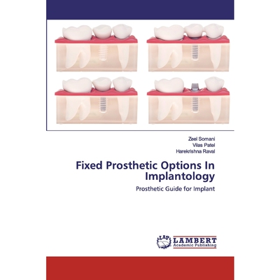 按需印刷不退不换Fixed Prosthetic Options In Implantology[9786202530118]