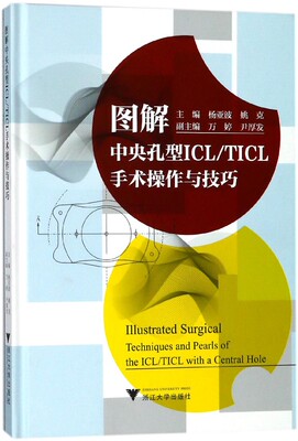 图解中央孔型ICL\TICL手术操作与技巧(精)
