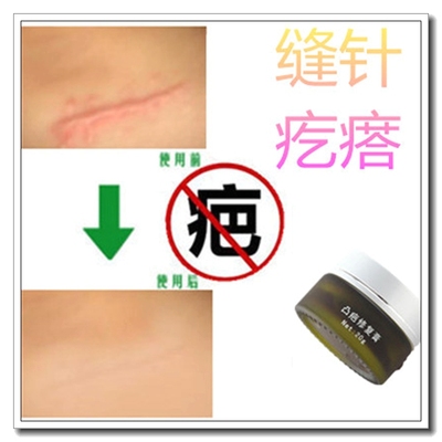 去除手术缝针伤疤痕灵正品舒痕胶去巴膏的药膏贴修复脸部抓伤凝胶
