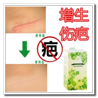 消祛手术摔伤疤痕伤口贴愈合凝胶去除耳洞凸起硬疙瘩陈旧修复药膏