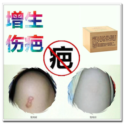 去剖腹产后伤口刀疤痕贴祛儿童疤痕灵除巴淡化黑色素红印修复药膏