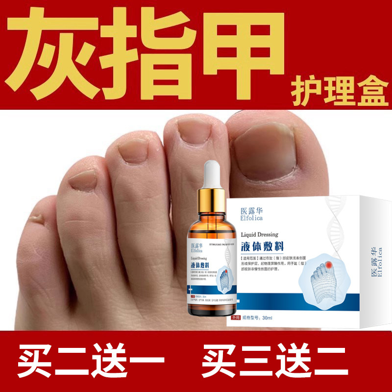 欢康灰指甲正品脱甲膏旗舰店修甲修脚刀冰醋酸灰甲液