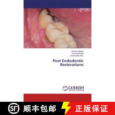 预订 Post Endodontic Restorations [9786200268303]