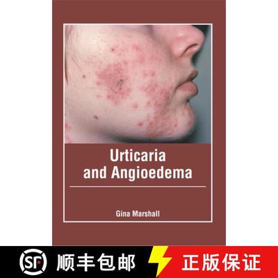 【3-4周达】Urticaria and Angioedema [9781632429247]