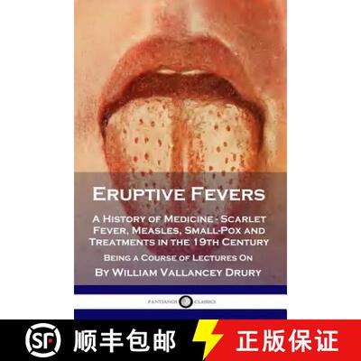 【3-4周达】Eruptive Fevers: A History of Medicine - Scarlet Fever, Measles, Small-Pox and Treatments ... [9781789870817]