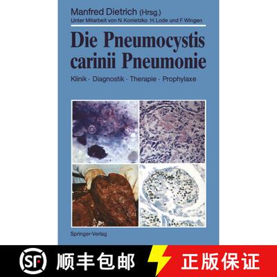 【3-4周达】Die Pneumocystis carinii Pneumonie: Klinik · Diagnostik · Therapie · Prophylaxe [9783540511779]