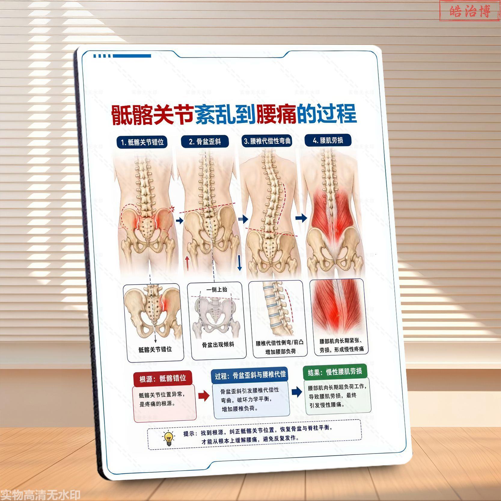 骶髂关节腰痛原理推拿馆面诊展示牌相框康复理疗店桌面装饰画摆台