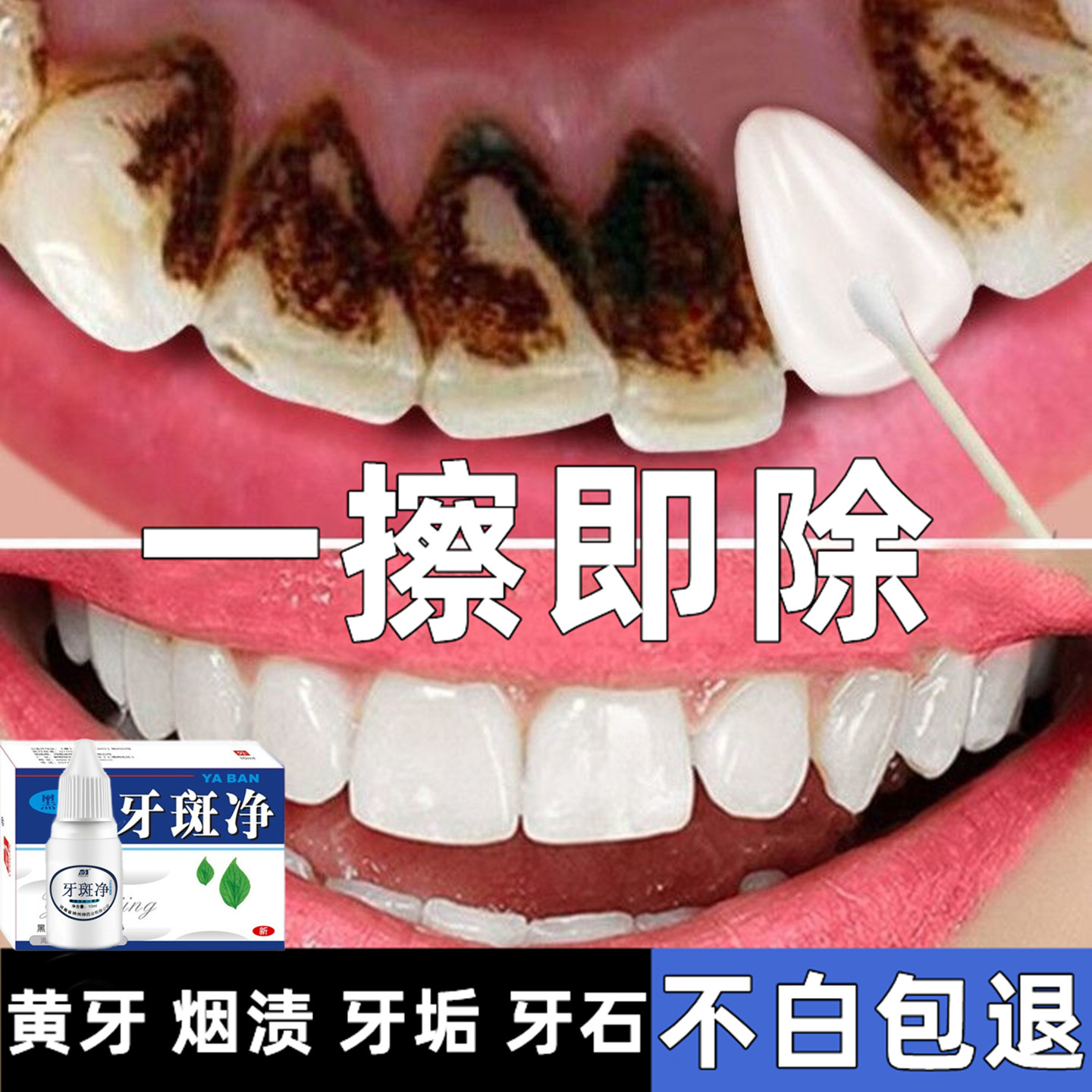 牙膏去黄去口臭美白强力去除烟渍茶牙垢牙结石溶解男女士专用神器