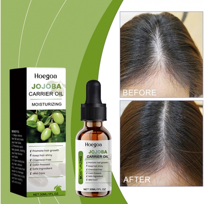 HOEGOA荷荷巴油密发精油深层润