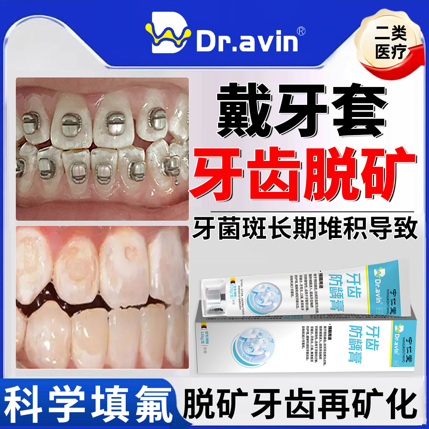 儿童牙齿脱矿白斑钙化搭正畸牙膏矫正含氟防龋再矿化专用护牙素ZY