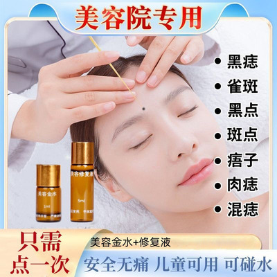 点斑去痣点痣膏脸部专用除去黑痣祛痣神器无痕正品美容点痣金水