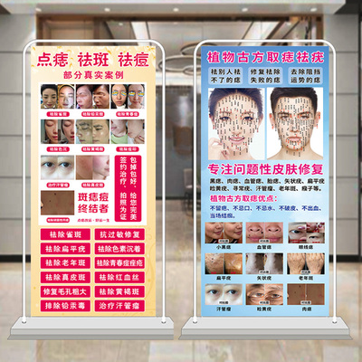 点痣宣传图美容院祛斑海报展架