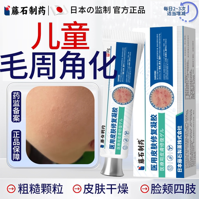 儿童毛周角化】皮肤修复凝胶