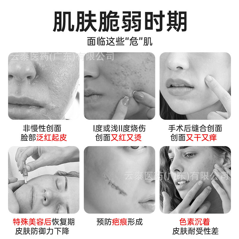 法兰度医用重组三型人源化胶原蛋白凝胶因子牛性表皮细胞生长疤痕