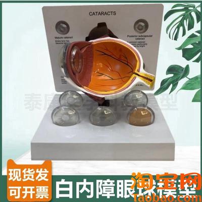 白内障眼睛模型可拆卸眼科医生用晶状体病变眼底U视网膜神经血管