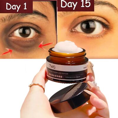 Círculos escuros Hidratante Eye Serum, Melhorar Eye Bags, L