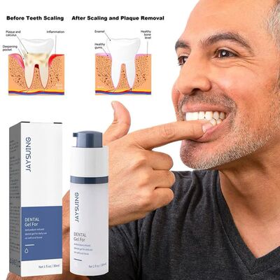 Gel blanqueador de dientes de 30ml, higiene bucal, pasta de