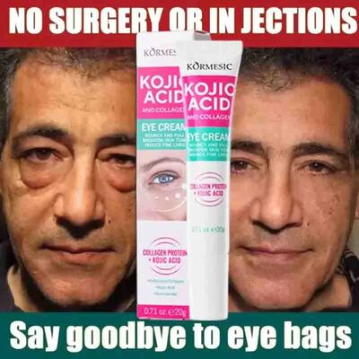 Instant Eye Bag Removal Cream Retinol Anti-Wrinkle Firming S