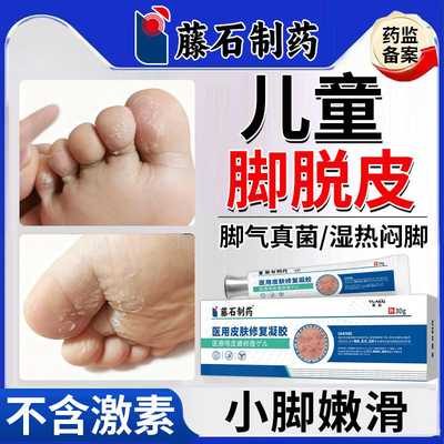 儿童脚脱皮专用膏脚气止痒脱皮杀菌真菌感染烂脚丫糜烂脚趾蜕皮KD