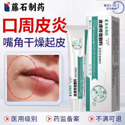 嘴角干燥起皮口周皮炎专药监备案膏用嘴巴周围红斑唇周炎脂溢性KD