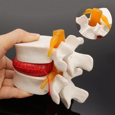 Dental 11 Human anatomy skeleton Spine Lumbar Disc Herniati