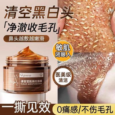 去黑头鼻贴深层清洁收缩毛孔粉刺神器撕拉面膜女男专用导出液正品