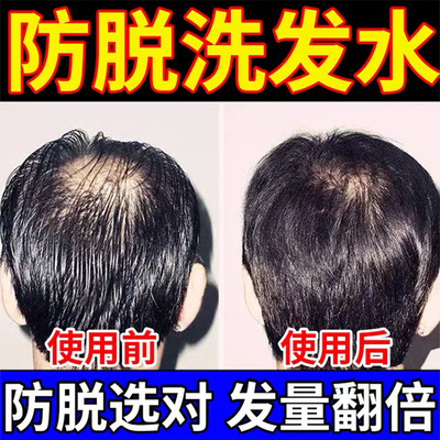 复方甘草酸苷 100 片特丰  正品保证RX