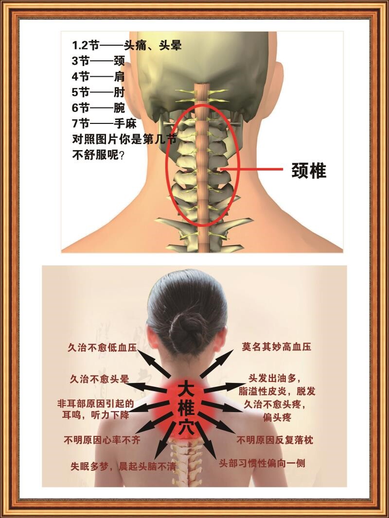 颈椎疾病的危害肩颈保养中医养生馆宣传海报美容院装饰画脊柱挂图