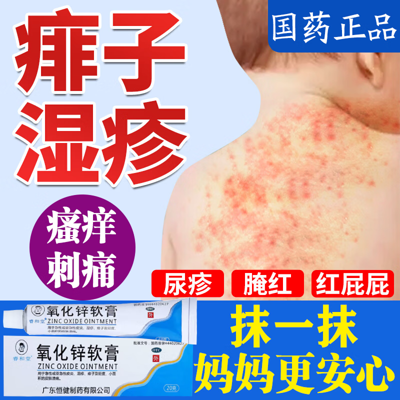 氧化锌软膏正品婴儿长痱子红屁屁皮炎湿疹专用止痒药膏非硫软膏痱