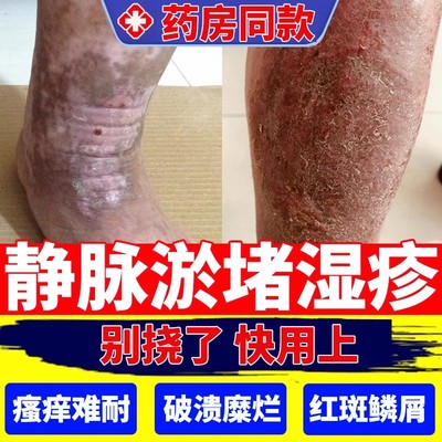 藤石制药医用皮肤修复凝胶