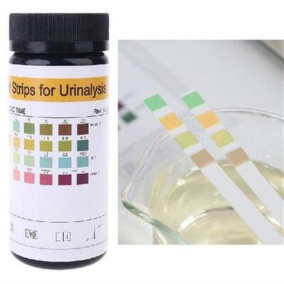 Urine Testing Strips4 Parameter Urinalysis Test Strips