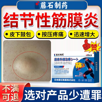 皮下鼓包疼痛结节性筋膜炎散结贴
