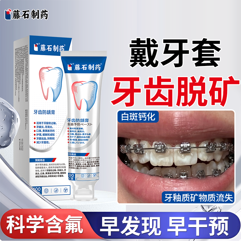 牙齿脱矿儿童成人青少年正畸矫正专用修复再矿化护牙素含氟牙膏JW