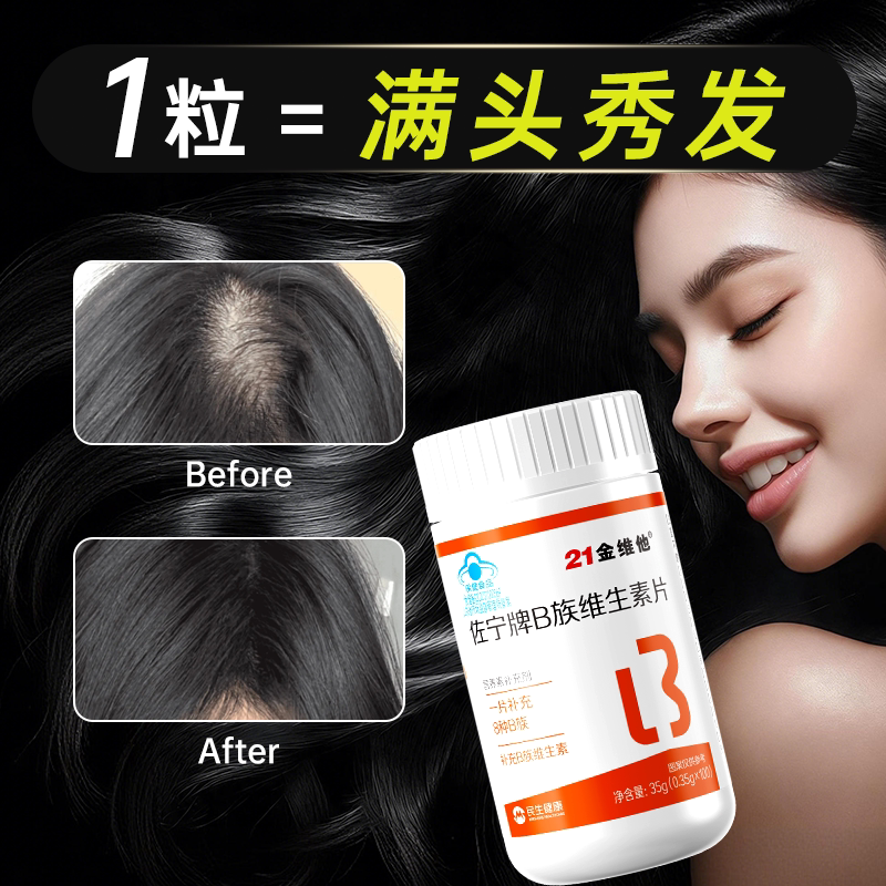 21金维他维生素b6防脱发生物素hb7复合族片铁锌掉头发严重生发