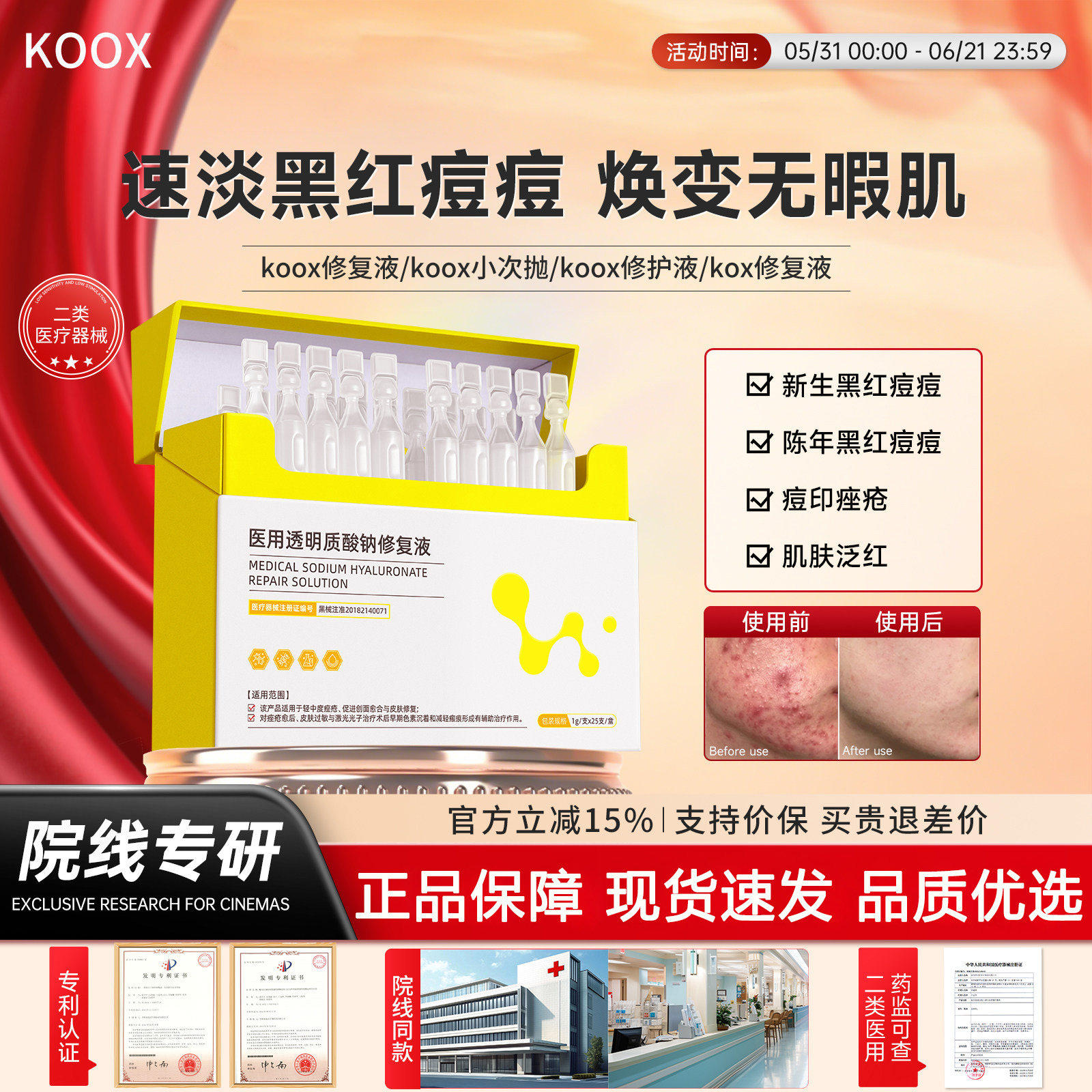 ko修复液koox修复液kox修复液koox小次抛次抛透明质酸钠官方正品