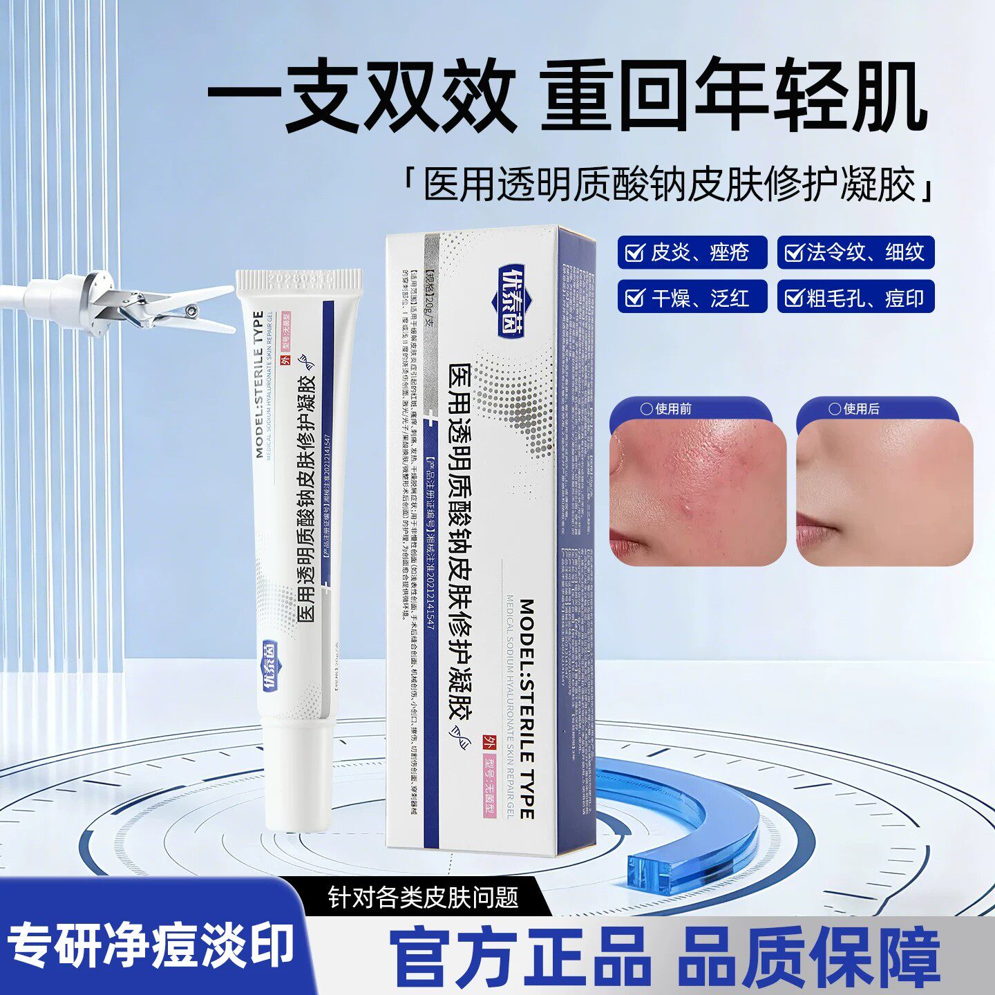 ytay小白管优泰茵去痘印毛孔闭口痤疮透明质酸钠痘痘医用修护凝胶