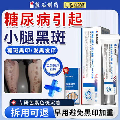 藤石制药糖尿病引起小腿黑斑去除胫前腿上糖斑皮肤痒色素沉着膏XP