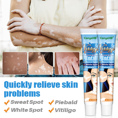 极速20g Herbal Extract Vitiligo Ointment LRemove Ringworm Wh