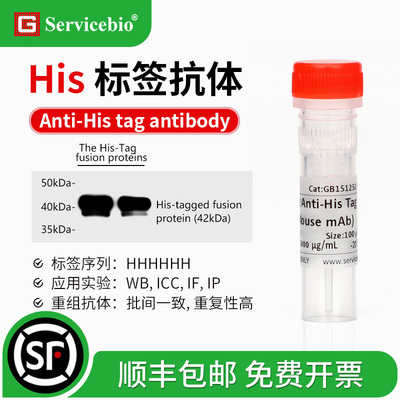 His 标签抗体 Anti-His Tag antibody 6xHis HHHHHH标签蛋白抗体